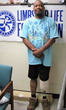 Limbs for Life Foundation | Restoring Lives, Step by Step!